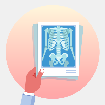 Diagnosis of Ankylosing Spondylitis – Good Health We Care